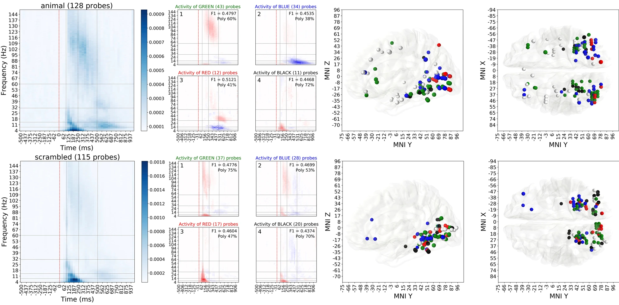 Detecting Salient Signal In Time Frequency Domain With Random Forests Neurotech Lab 7501